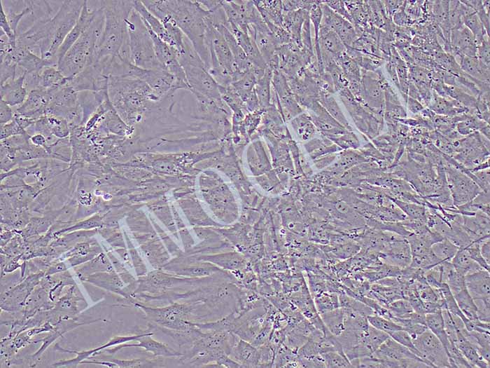 HTMC(人眼小梁网细胞)(STR鉴定)-逸漠细胞库