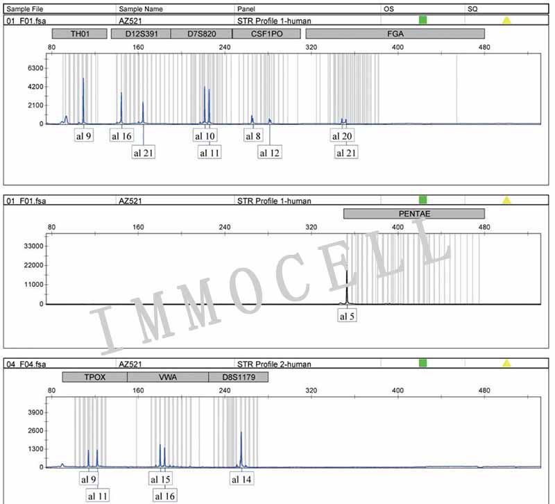 NCI-N87细胞(人胃癌细胞)(STR鉴定正确)-逸漠细胞库