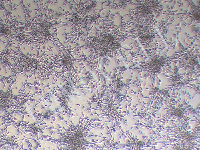 MC38-FLUC-puro小鼠结肠癌细胞(FLUC标记)-逸漠细胞库