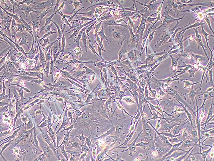 U251MG-FLUC-puro人类星型胶质瘤细胞(FLUC标记)-逸漠细胞库