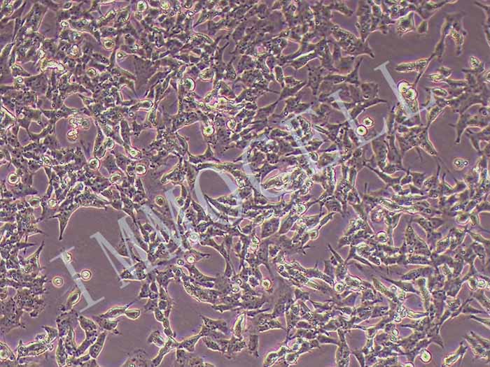 SK-N-BE(2)人神经母细胞瘤细胞(STR鉴定正确)-逸漠细胞库