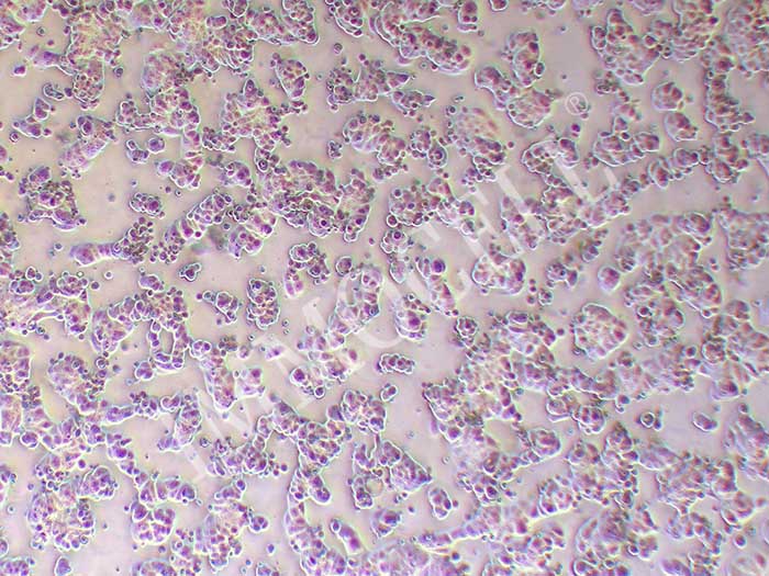 MCF-7细胞(人乳腺癌细胞)(STR鉴定正确)、MCF-7-逸漠细胞库