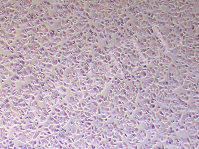 MCF-7细胞(人乳腺癌细胞)(STR鉴定正确)、MCF-7-逸漠细胞库