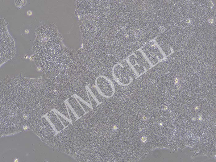 hESC(H1)人胚胎干细胞(STR鉴定正确)-逸漠细胞库