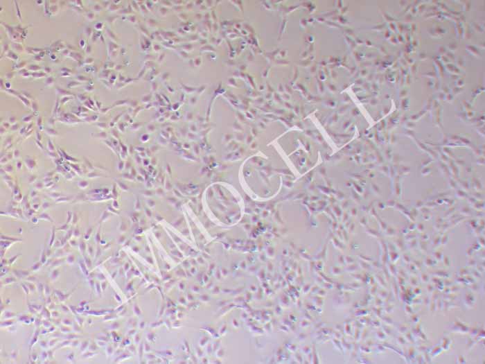 BEAS-2B细胞(人正常肺上皮细胞)(STR鉴定)-逸漠细胞库