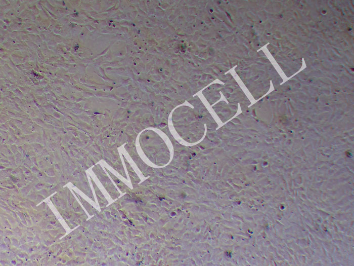 HBVP-SV40T-hTERT人脑血管周细胞永生化-逸漠细胞库