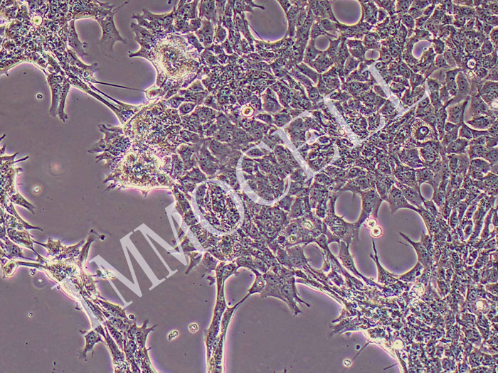 hep-53.4小鼠肝癌细胞 德国引进-逸漠细胞库
