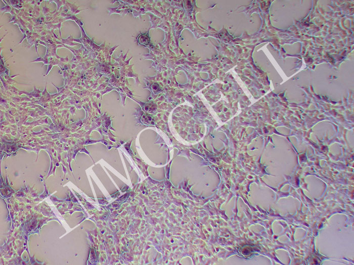 hep-53.4小鼠肝癌细胞 德国引进-逸漠细胞库