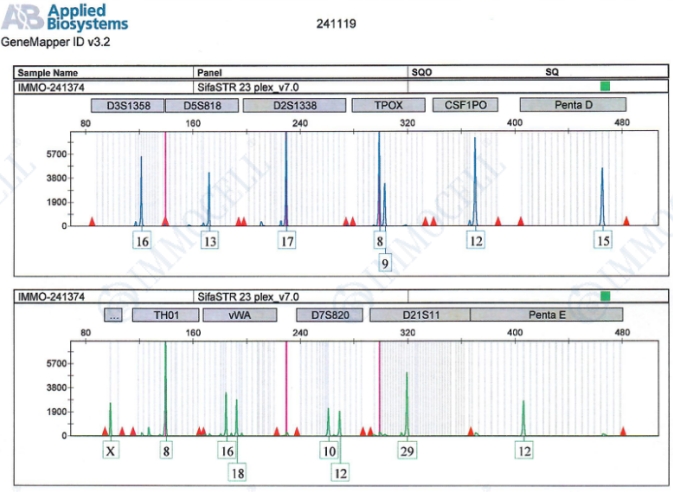 HCC1806人乳腺鳞状癌细胞(三阴性)(STR鉴定)-逸漠细胞库