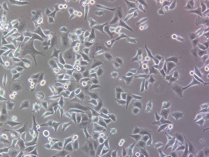 PANC-1细胞(人胰腺癌细胞)(STR鉴定正确)-逸漠细胞库