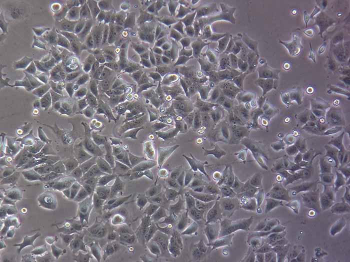 MCF-7细胞(人乳腺癌细胞)(STR鉴定正确)-逸漠细胞库