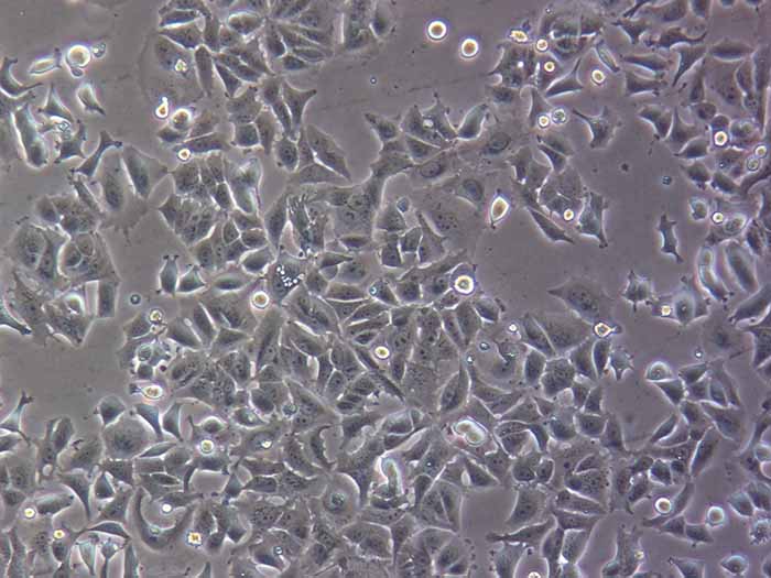 MCF-7细胞(人乳腺癌细胞)(STR鉴定正确)-逸漠细胞库