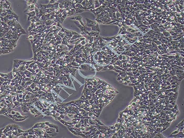 Hep G2细胞(人肝癌细胞)(STR鉴定正确)-逸漠细胞库