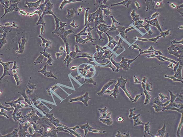 INS-1细胞(大鼠胰岛细胞瘤细胞)-逸漠细胞库