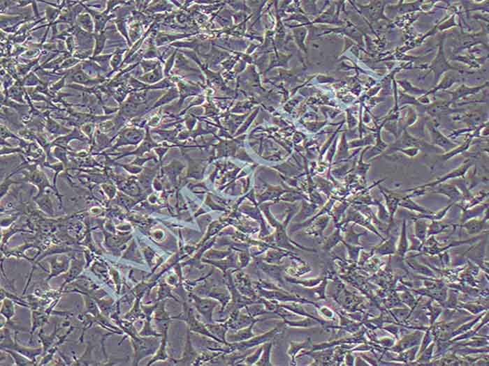B16F10-LUC(小鼠黑色素瘤细胞-荧光素酶标记)-逸漠细胞库